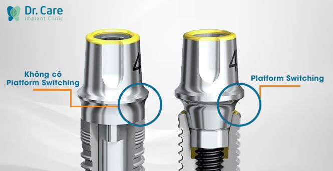 Top 10 dòng trụ Implant phổ biến nhất hiện nay | Dr. Care